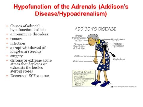 Adrenal Hypofunction – Addison’s Disease Wellness – NutriMedical