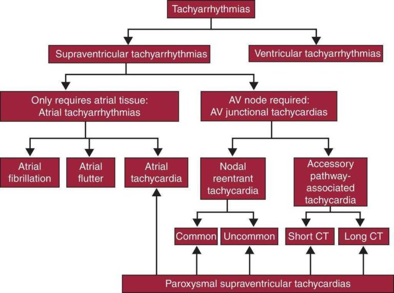 Heart Arrythmias and Palpitations ATRIAL FIBRILLATION - NutriMedical